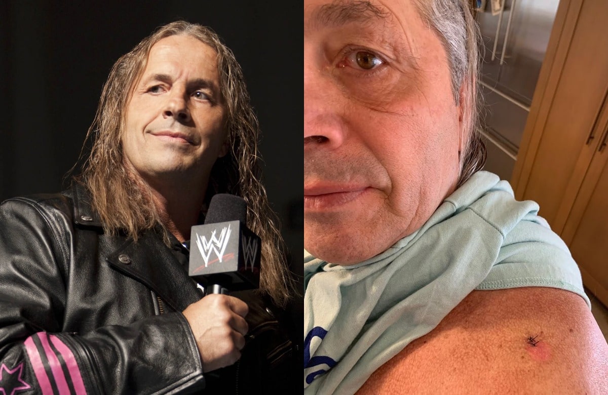 Bret Hart Reminds Fans To Get Checked Following His Skin Cancer ...